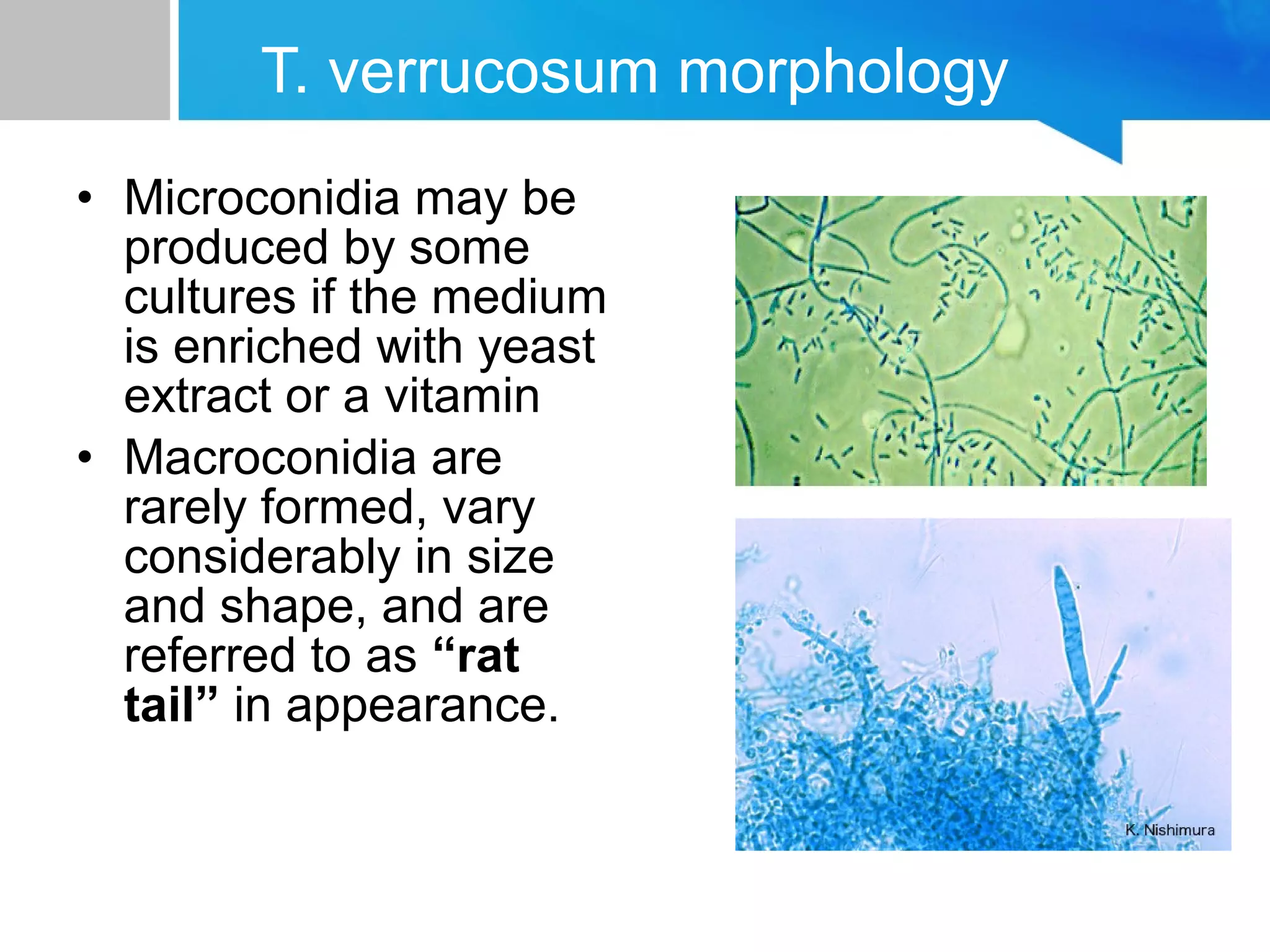 Trichophyton and Epidermophyton | PPT