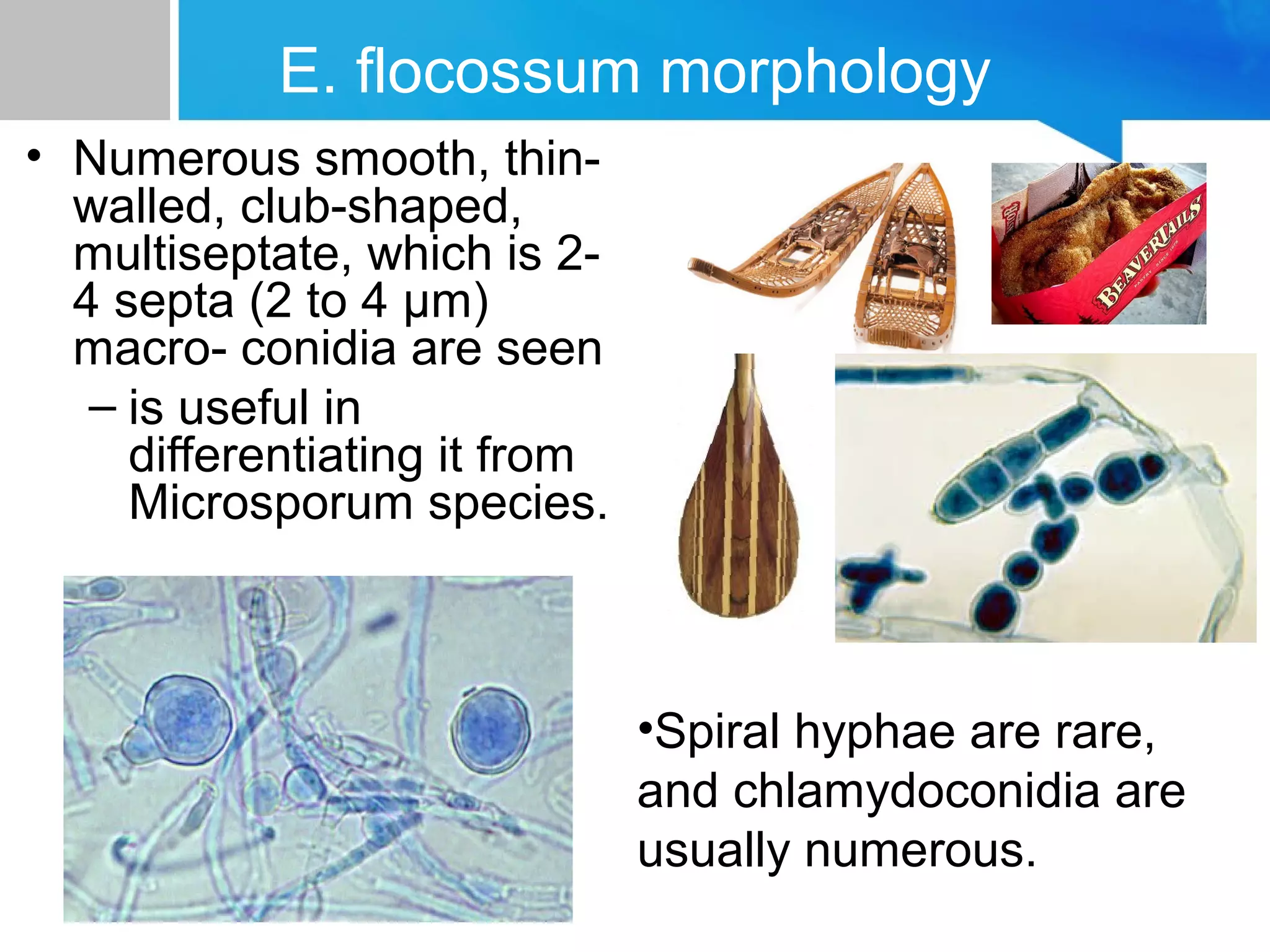 Trichophyton and Epidermophyton | PPT