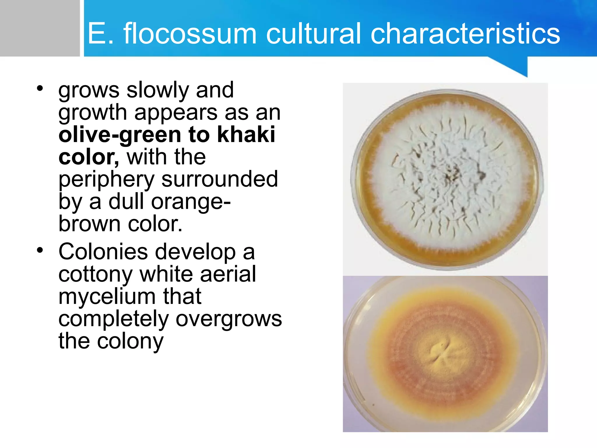 Trichophyton and Epidermophyton | PPT