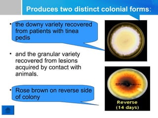 Trichophyton and Epidermophyton | PPT