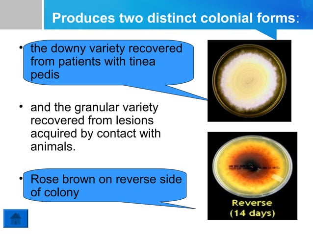 Trichophyton and Epidermophyton | PPT | Skin and Dermatology | Diseases ...