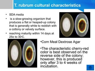 Trichophyton and Epidermophyton | PPT