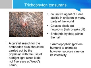 Trichophyton and Epidermophyton | PPT