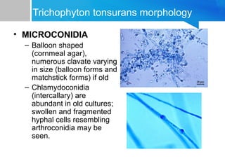 Trichophyton and Epidermophyton | PPT