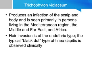 Trichophyton and Epidermophyton | PPT