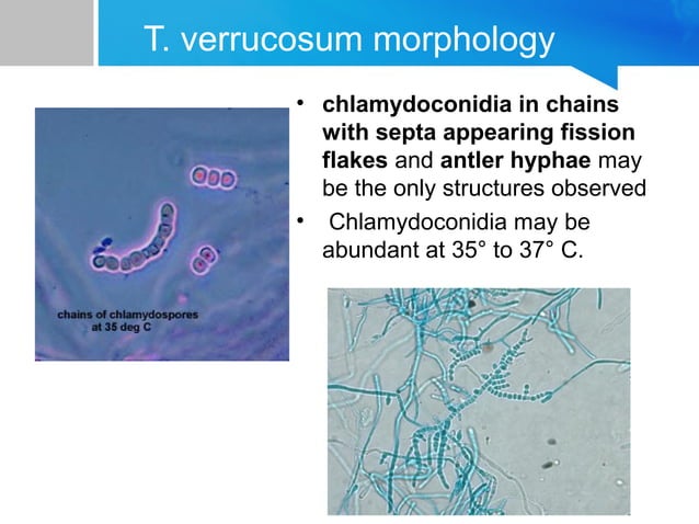 Trichophyton and Epidermophyton | PPT