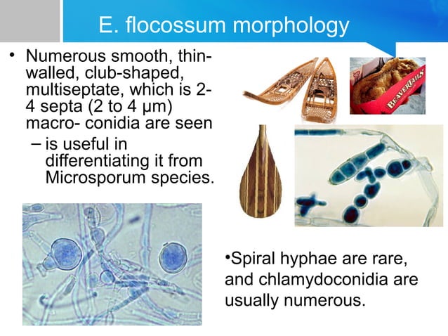 Trichophyton and Epidermophyton | PPT | Skin and Dermatology | Diseases ...