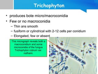Trichophyton and Epidermophyton | PPT