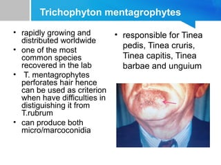 Trichophyton and Epidermophyton | PPT