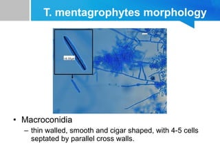 Trichophyton and Epidermophyton | PPT