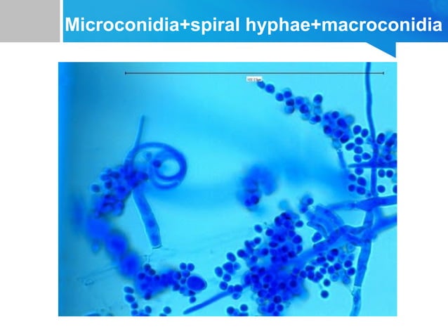 Trichophyton and Epidermophyton | PPT | Skin and Dermatology | Diseases ...