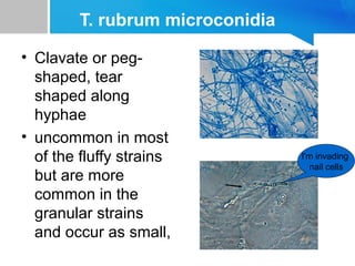 Microconidia