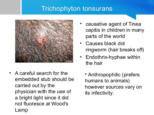 Trichophyton and Epidermophyton