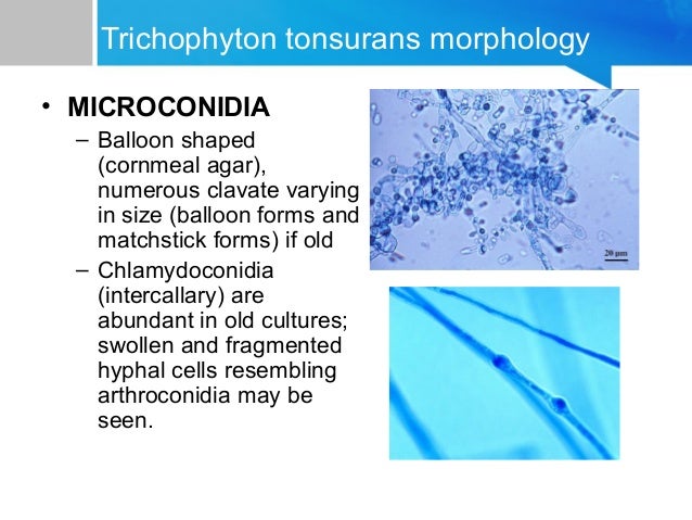 Trichophyton and Epidermophyton