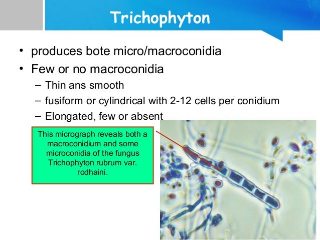 Trichophyton and Epidermophyton