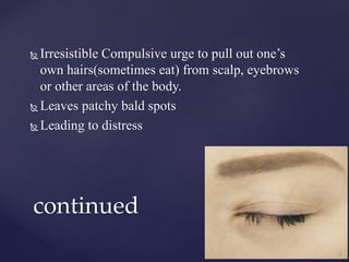 Trichotillomania | PPT