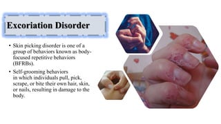 Trichotillomania and excoriation disorder | PPTX