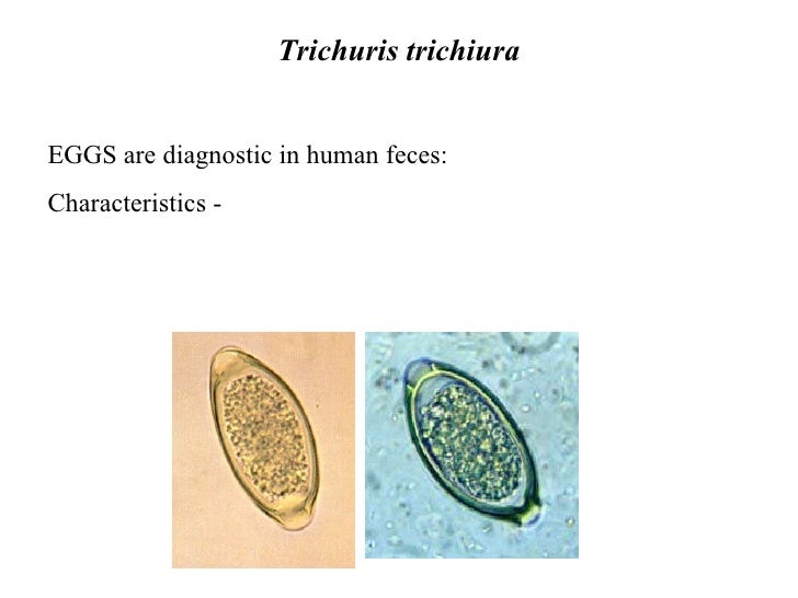 Trichurids