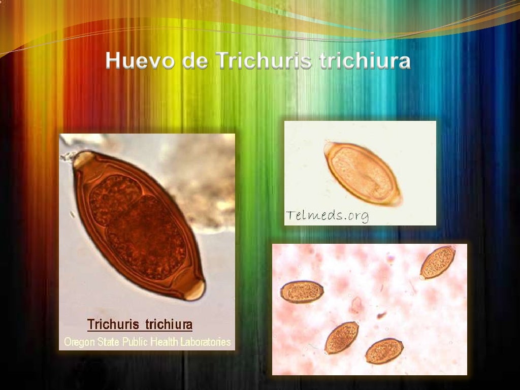 Trichuris trichiura