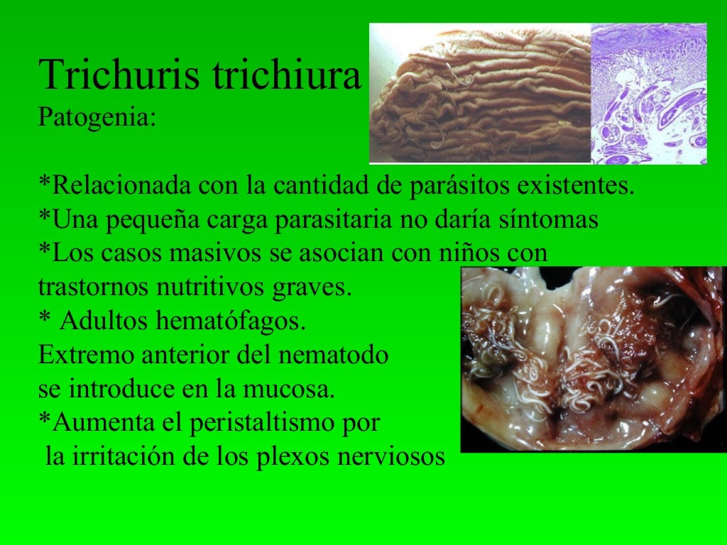 Trichuris trichiura