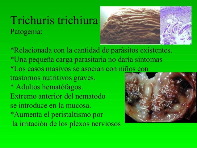Trichuris trichiura