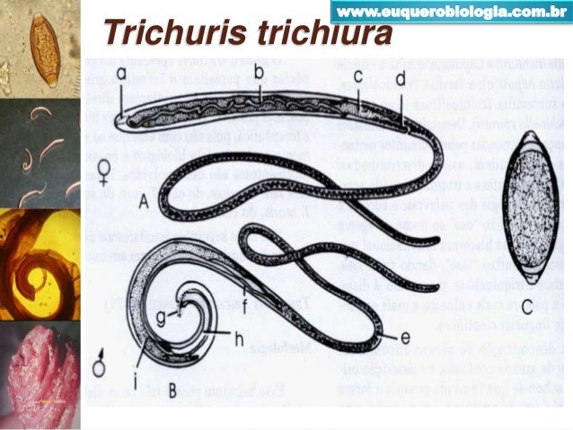 Trichuris trichiura - PDF/PPT