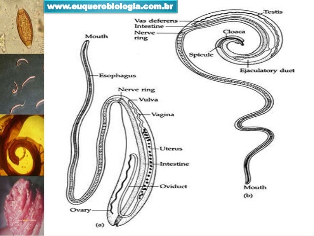 Trichuris trichiura - PDF/PPT