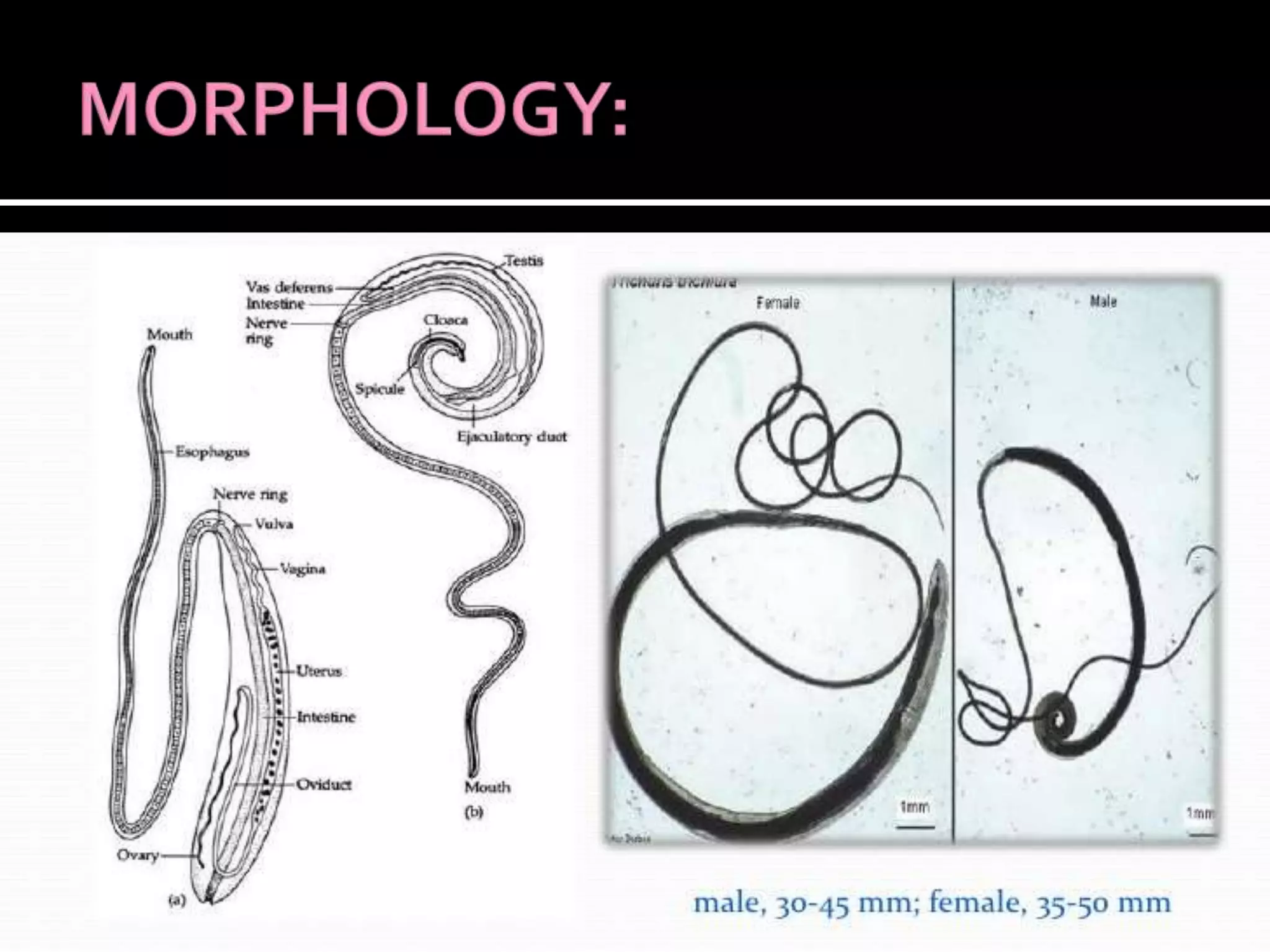 Trichuris trichiura | PPTX