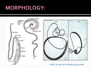 Trichuris trichiura | PPTX