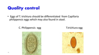 Capillaria Egg Vs Trichuris Egg
