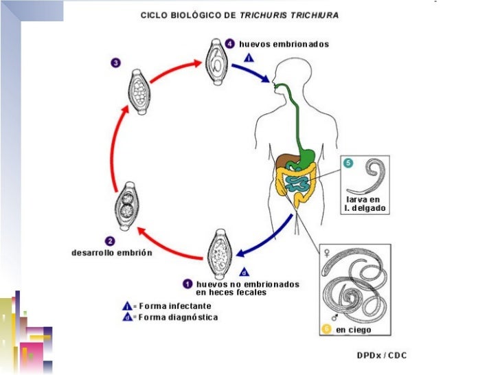 Trichuris Trichiura Rotulado
