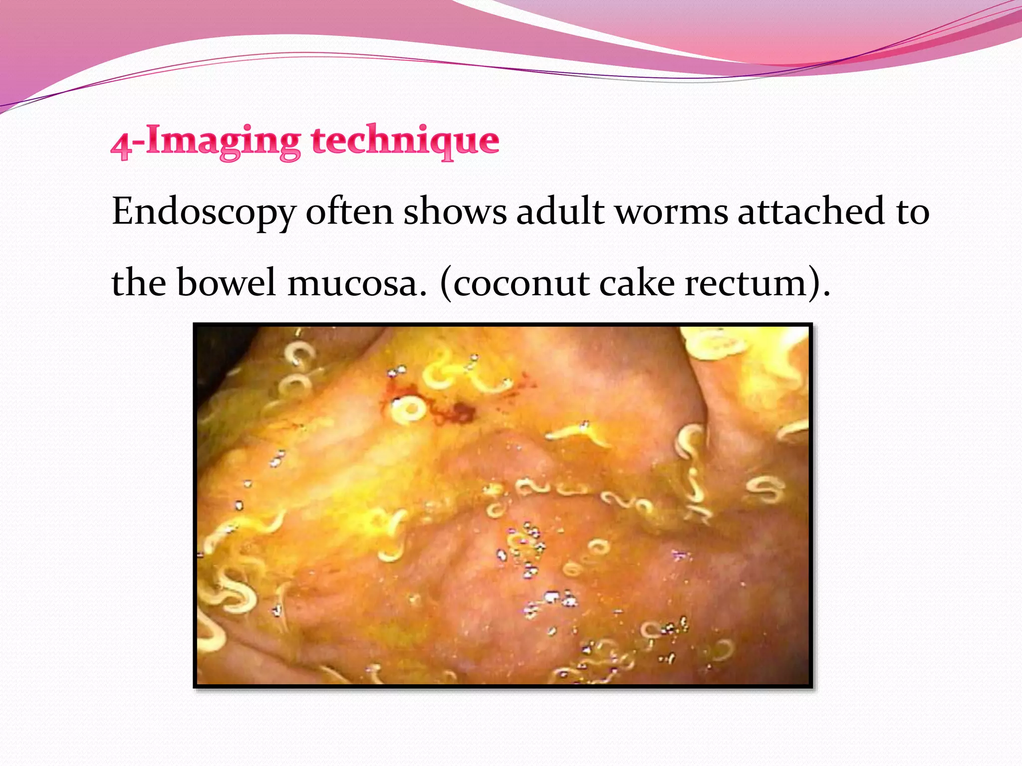 Trichuris trichuria | PPTX