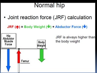 Trick movements of hip & pelvis | PPTX