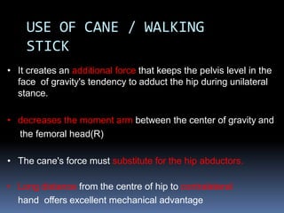 Trick movements of hip & pelvis | PPTX