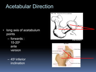 Trick movements of hip & pelvis | PPTX