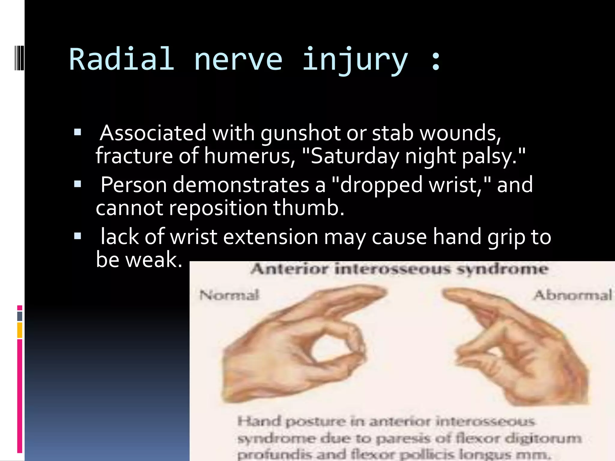 Trick movements of wrist & hand | PPTX | Death, Injury, or Military ...