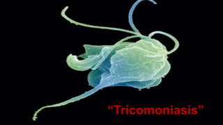 Tricomoniasis | PPT
