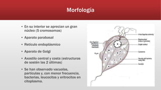 Tricomoniasis | PPTX