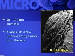 Tricodina parasite | PPTX