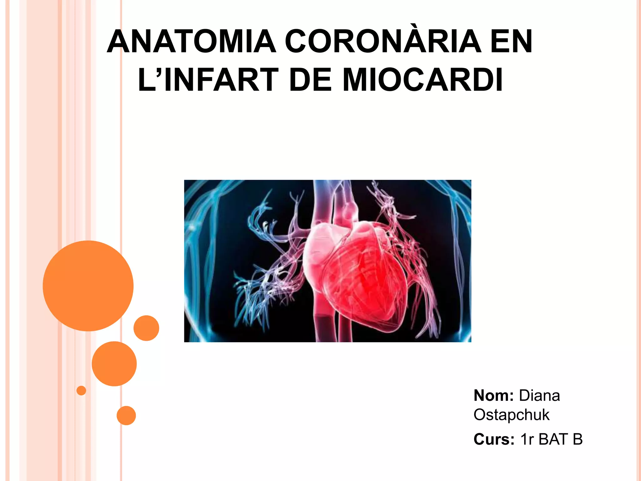 Anatomia coronària en l'infart de miocardi | PPTX