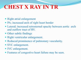 Tricuspid pulmonary valves | PPTX