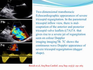 Tricuspid pulmonary valves | PPTX