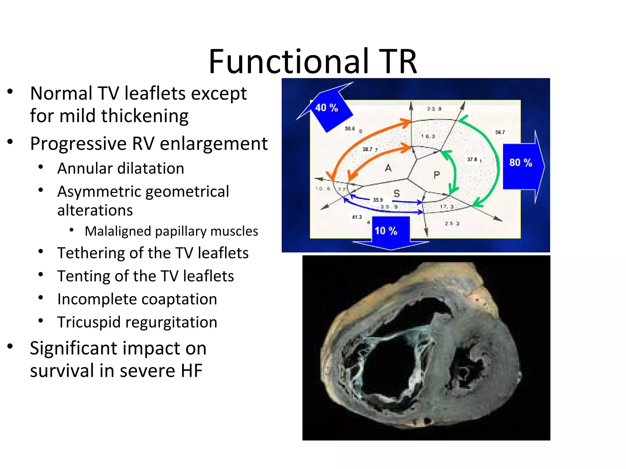 Tricuspid and pulmonic valves 2011 | PPT