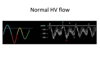 Tricuspid and pulmonic valves 2011 | PPT