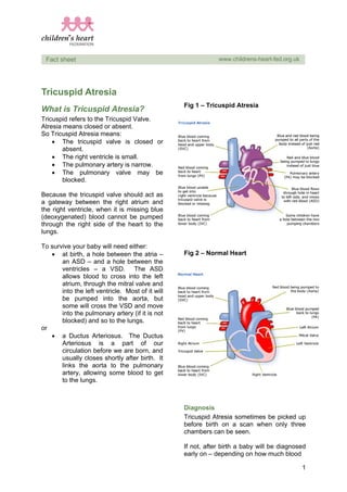 Tricuspid atresia | PDF