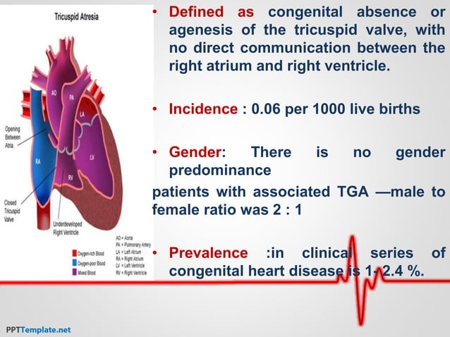 Tricuspid atresia | PPTX