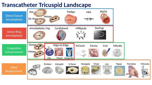 Tricuspid interventions Cardioinnovation | PPT