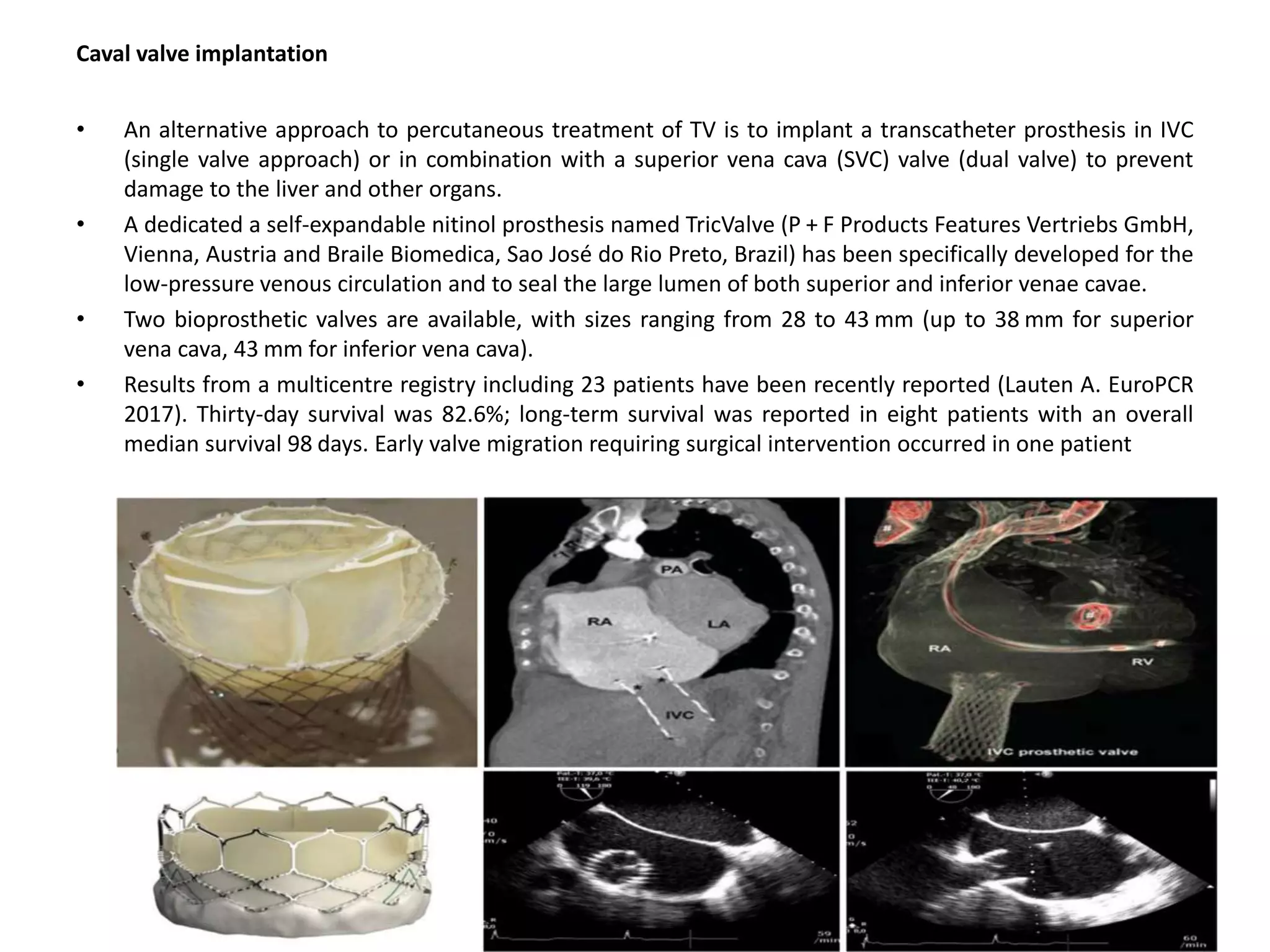 Tricuspid interventions | PPTX