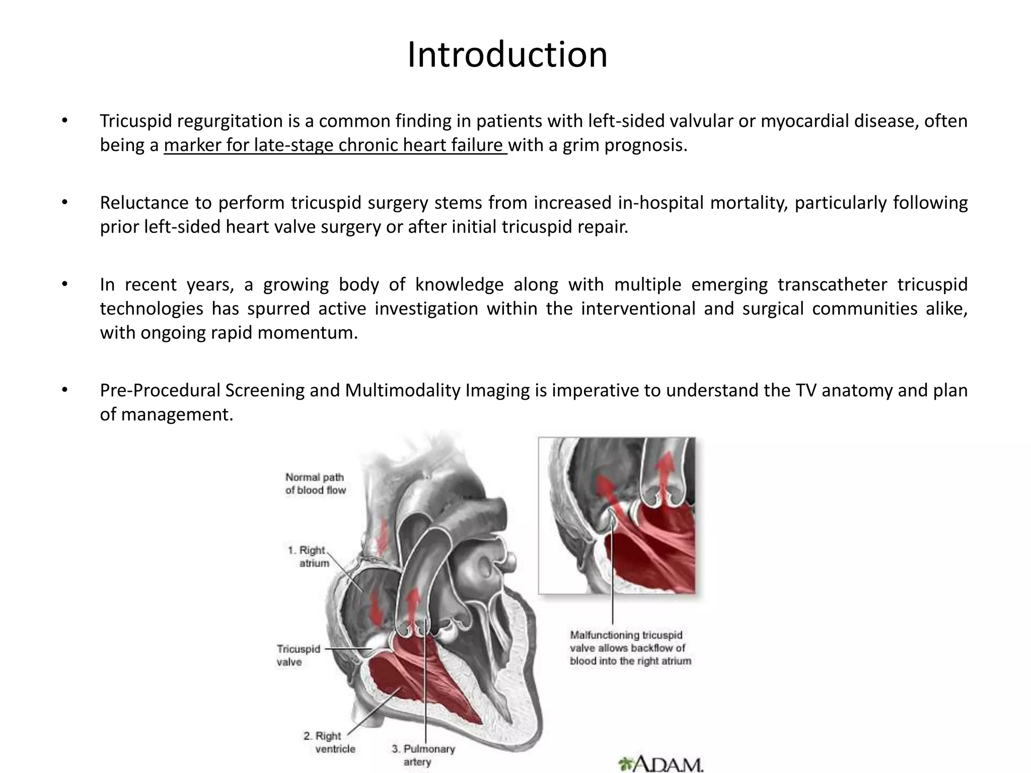 Tricuspid interventions | PPTX