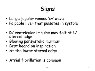 Tricuspid stenosis | PPTX